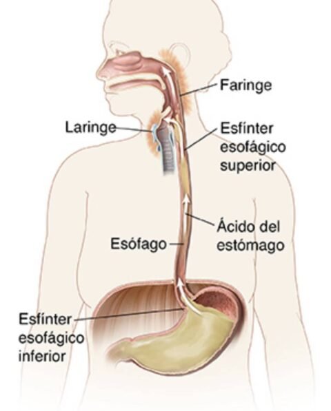 Esfinter esofágico interior | Cirujano de Torax